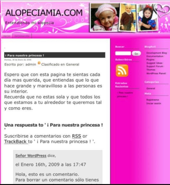 Our Alopecia Journey